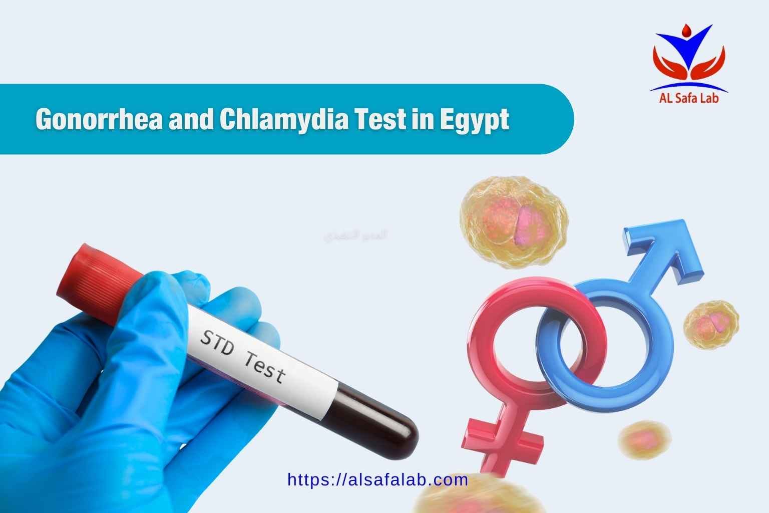 Gonorrhea and Chlamydia Test: Al Safa Lab